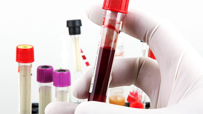 Psoriasis Center of Excellence | Medscape