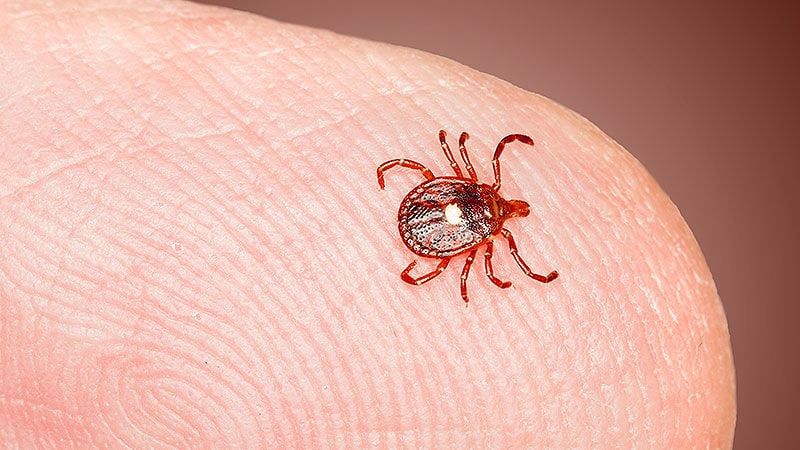 Alpha-Gal Syndrome, the Meat Allergy, Expands Its Reach