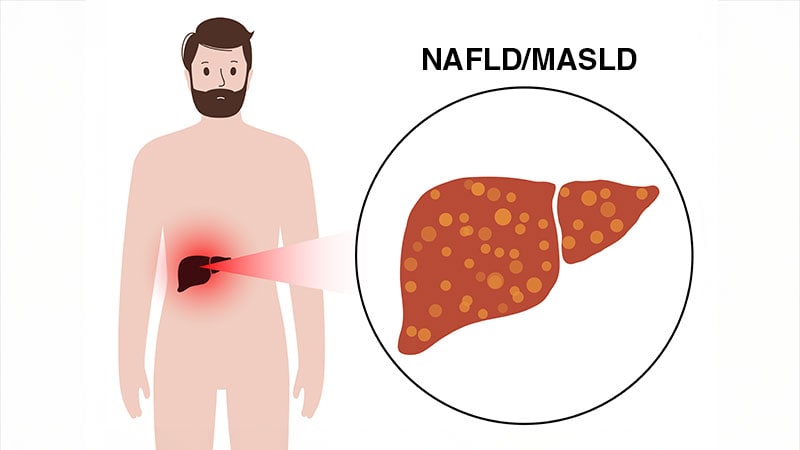 Real-World Pros & Cons of the New Liver Disease Nomenclature
