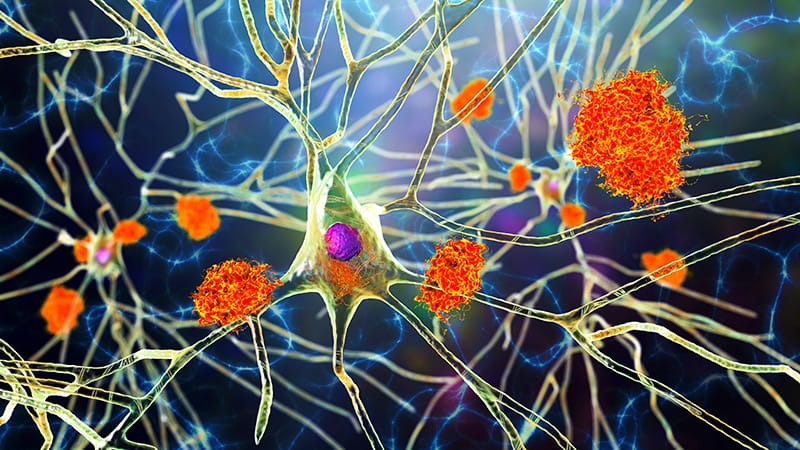 More Evidence Lowering Amyloid Is Beneficial in Early AD