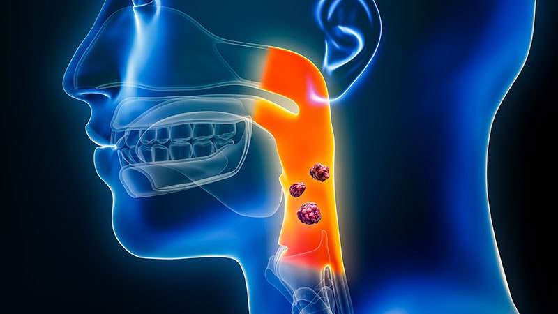 Pre-op Immunotherapy for Head and Neck Cancer Rising