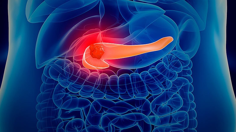 New Endoscopic Method Reduces Pancreatitis