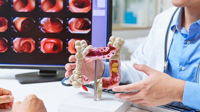 Is It Safe to Skip Surgery After Colorectal Polyp Removal?
