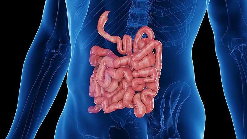 Small-Bowel Rebleeding: P1 Lesions Linked to Higher Risk