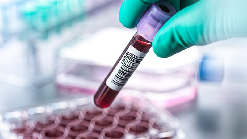 Redefining Cognitive Assessment With One Blood Test