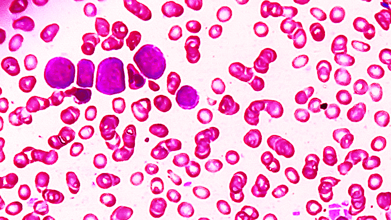 How Nanotech Made an Old Leukemia Drug 22,000x Stronger