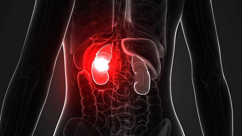 Primary Care for Kidney Failure Linked to Fewer ER Visits