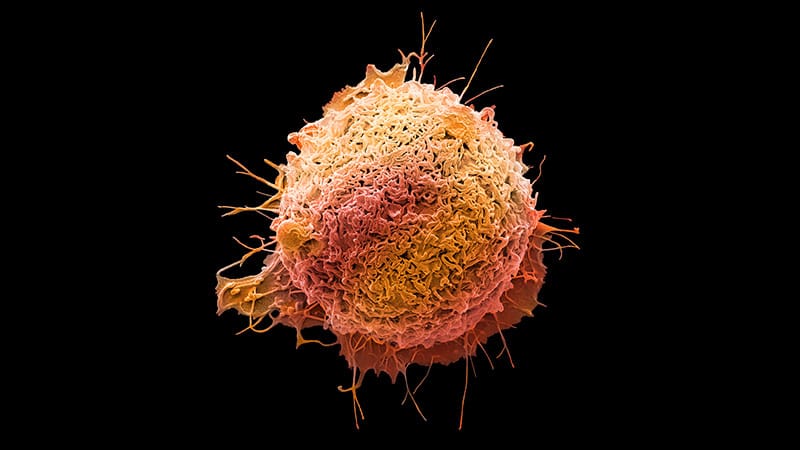 New Nanoparticles Can Destroy Undruggable Cancer Proteins