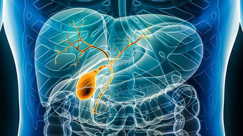 Robotic Cholecystectomy Tied to Higher Bile Duct Injury Risk