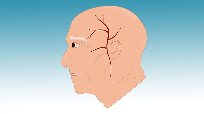 Pinpoint Giant Cell Arteritis in Primary Care