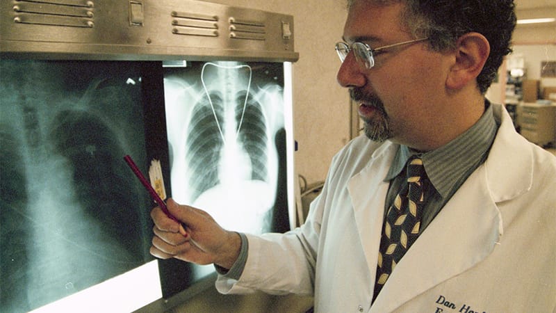 Serratus Plane Block Shows Benefits in Acute Rib Fractures