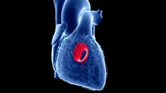 New Valves Treat ‘No-Option’ Heart Patients