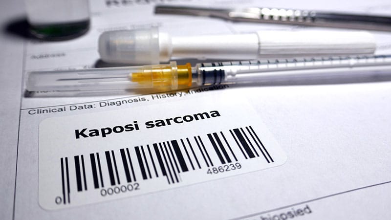 Early-Onset Kaposi Sarcoma Shows Indolent Course