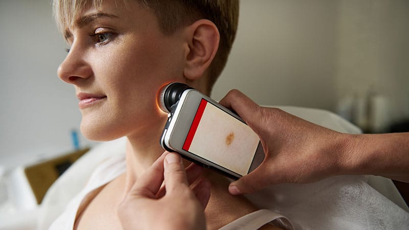 AI Device Enhances Skin Cancer Diagnosis in Primary Care