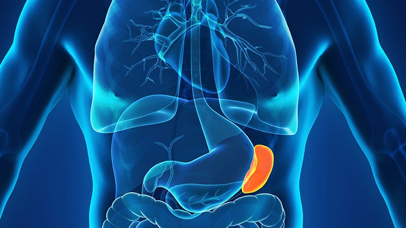 Caso clinico - Uomo di 70 anni con rottura splenica atraumatica