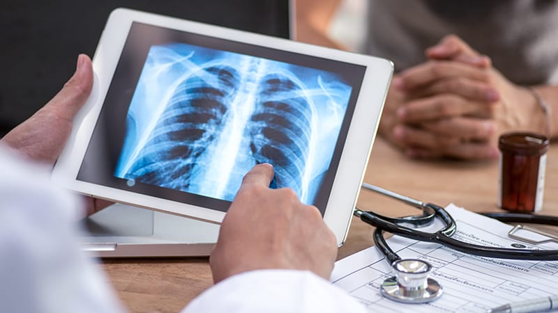 Pneumonia | Medscape