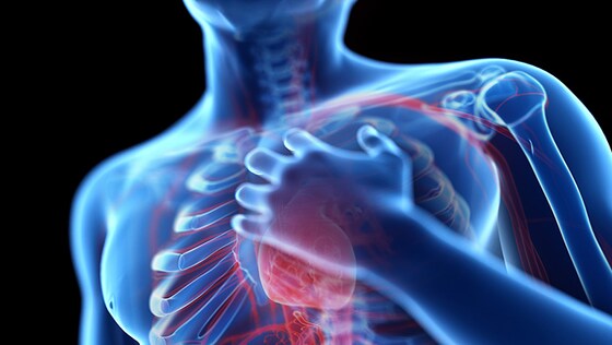 ESC 2023 - Faut-il revoir la classification des infarctus du myocarde ...