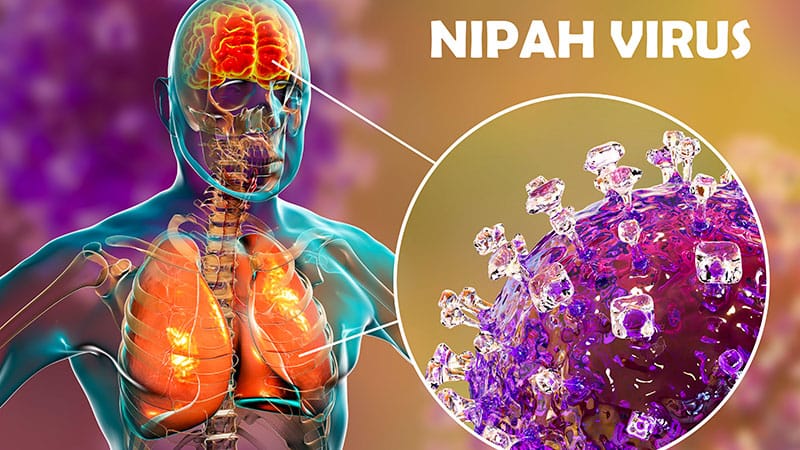 Nipah Virus Vaccine Research to Prepare for the Future