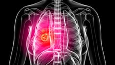 EMA Clears New First-Line Options for Advanced Cancers