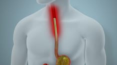 When Burping Becomes a Medical Problem — and How to Solve It