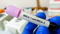 BRCA Carriers: Risk-Reducing Double Mastectomy Saves Lives