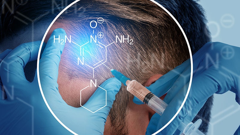 Infants Exposed to Minoxidil May Develop Hypertrichosis