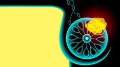 Preoperative MRI for Breast Cancer: Is It Worth It?