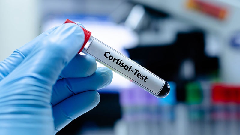 Social Media Fuels Dubious Cortisol Craze