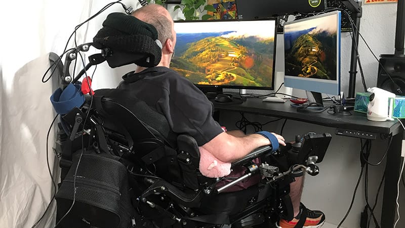 Advanced Brain-Computer Interface Restores Speech in ALS