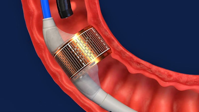 T2D: Insulin-Free for 24 Months After Endoscopic Procedure