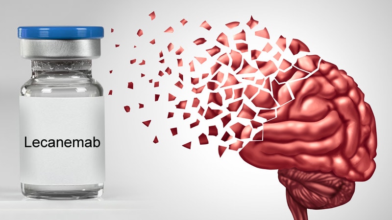 FDA OKs Subcutaneous Lecanemab for Early AD