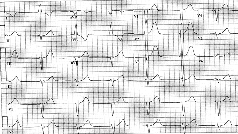 Internal Medicine - Medscape