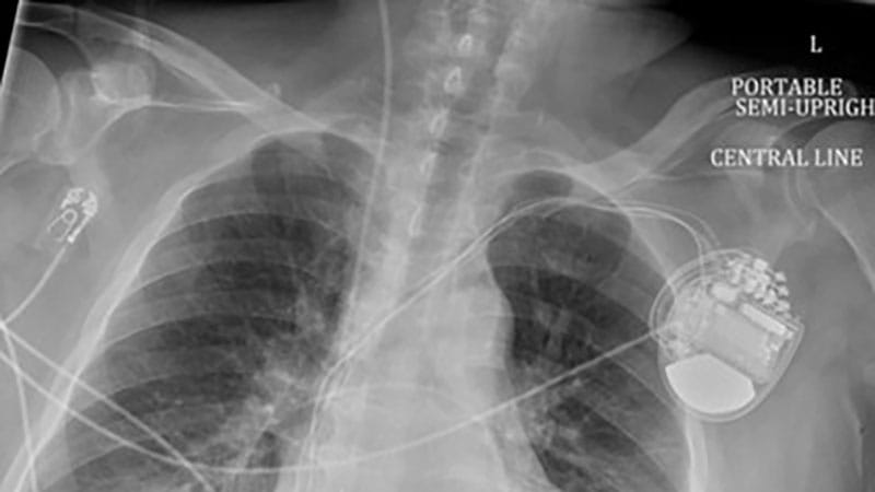 Pulmonary Medicine - Medscape