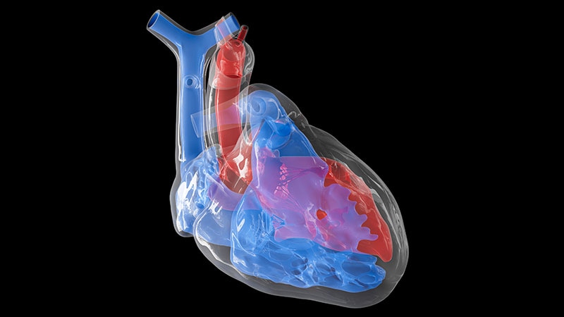 Fast Five Quiz: Dyslipidemia and CV Risk Stratification