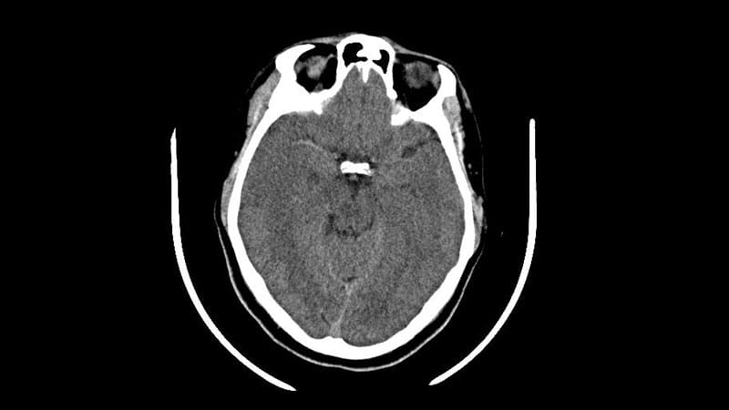 Man With a Violent Cough Develops Ptosis and Slurred Speech