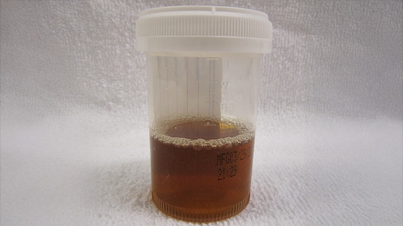 Schizophrenie: Neuartige Formulierung „KarXT“ mit guter ...