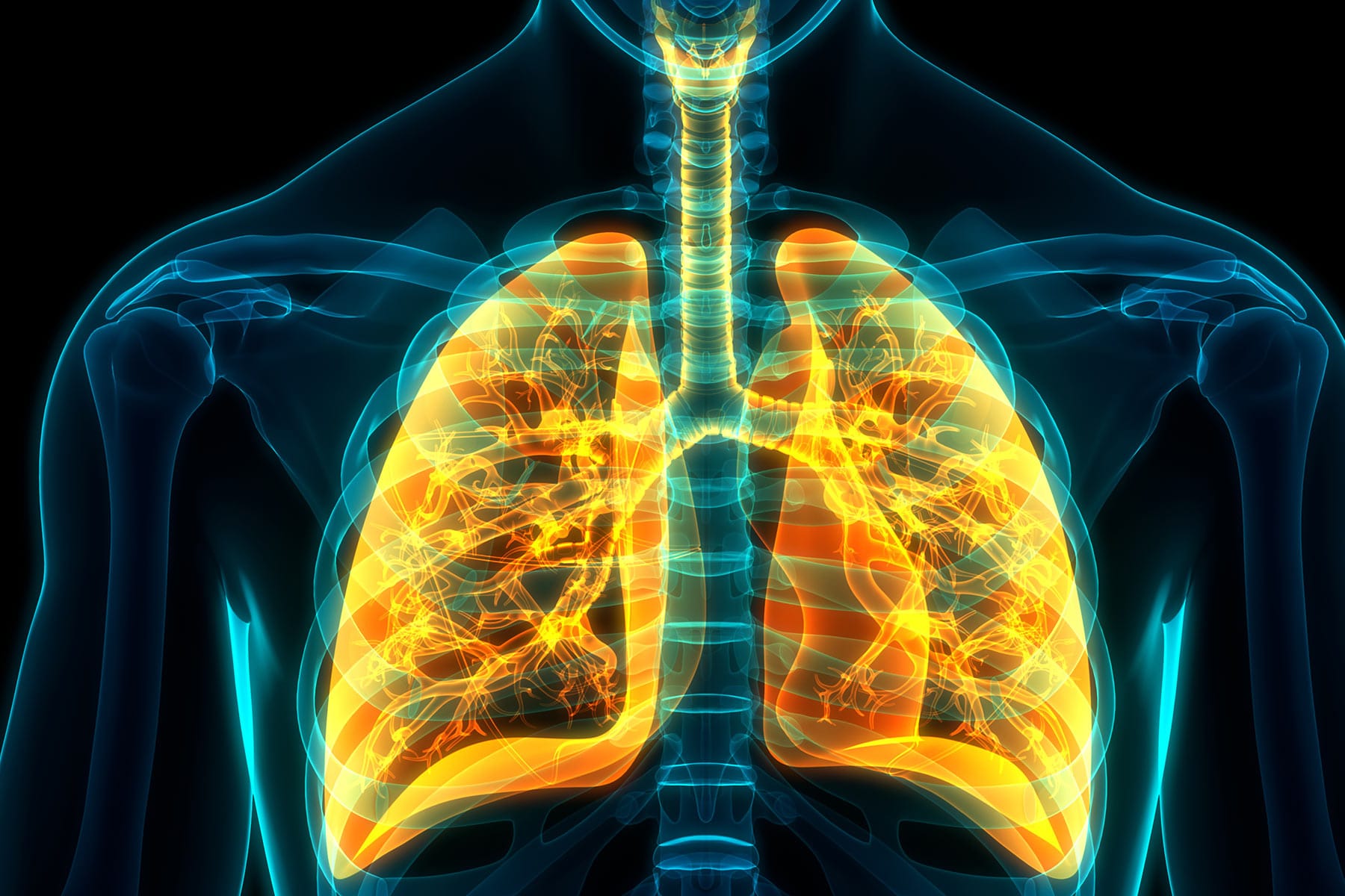 Potential New Treatment Option for COVID-related ARDS