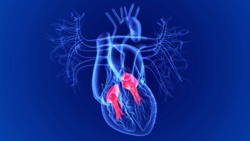 Timing of Heart Valve Surgery Crucial Shows Research