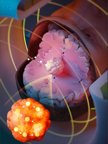 Cancer: Seeds of Destruction Developed To Attack Brain Tumour Cells