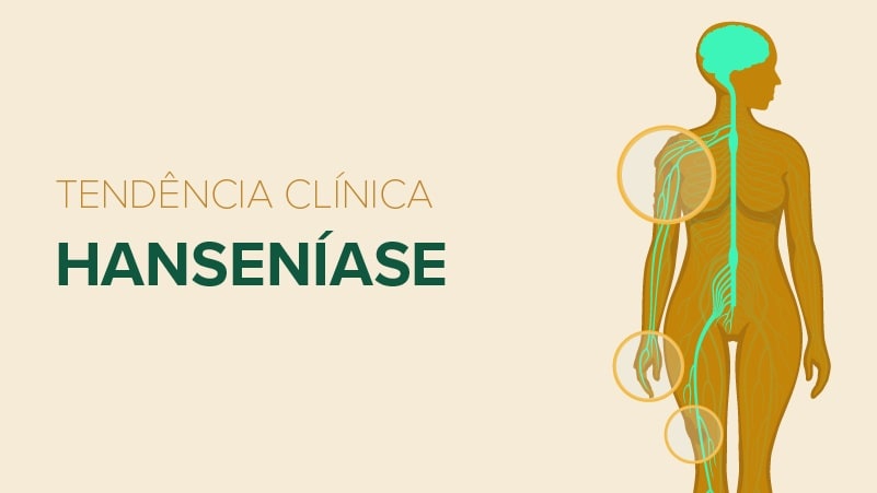 Tendência Clínica: Hanseníase