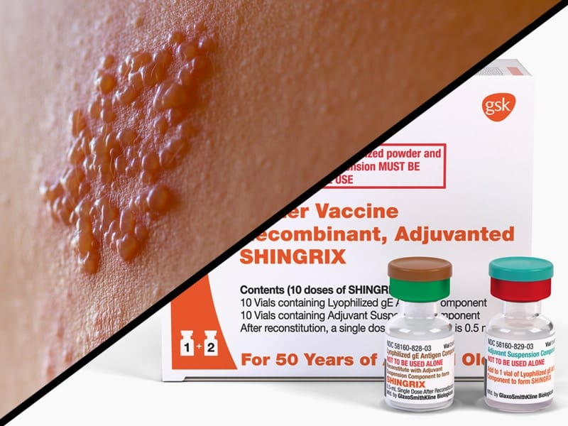 Changes to Shingles Immunisation Programme