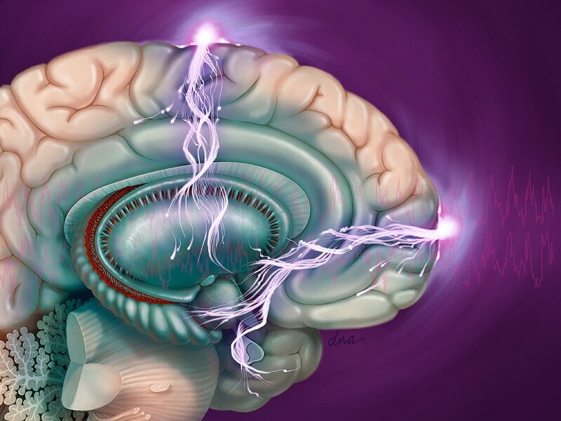 More Than a Third of ECT in England Given Without Consent